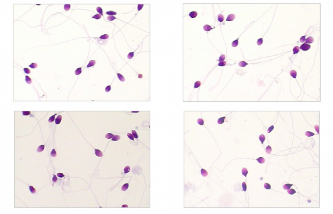 Kit de tinción Diff Quik de uso simple para morfología de espermatozoides 100ml/Kit